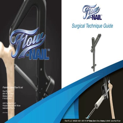 Flow-FX ~ Flow Nail Surgical Technique Guide | PDF