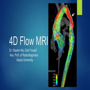 4D FLOW MRI | PPTX