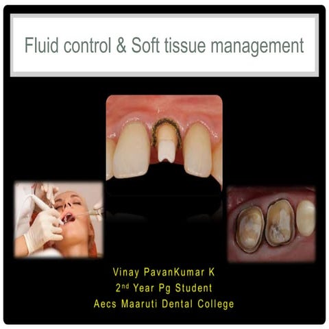 Temporization in fixed prosthodontics | PPTX