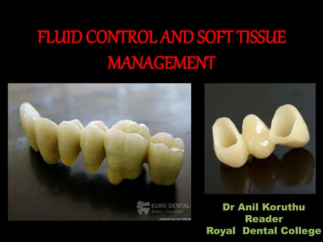 Gingival Tissues management.ppt