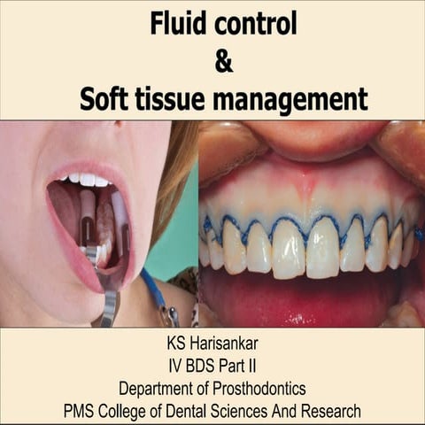Fluid control and Soft tissue management | PPT