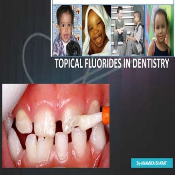 Topical Fluorides in dentistry | PPTX