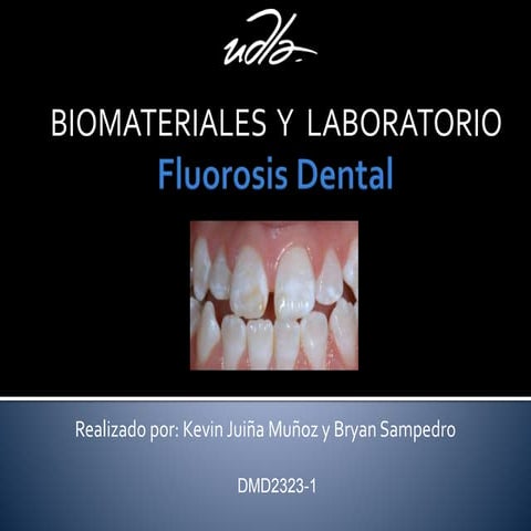 Fluorosis | PPTX