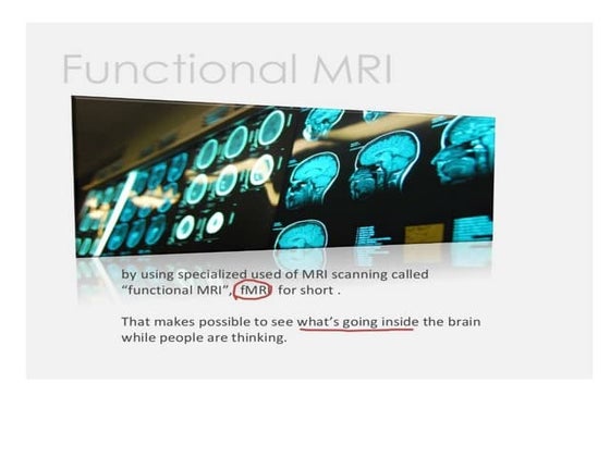 fMRI Presentation | PPT