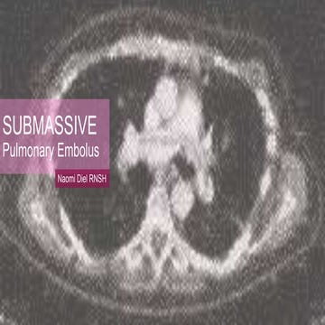 How I manage: Submassive PE by Dr Naomi Diel | PPTX