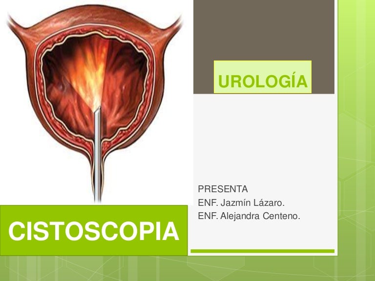 Cistoscopia
