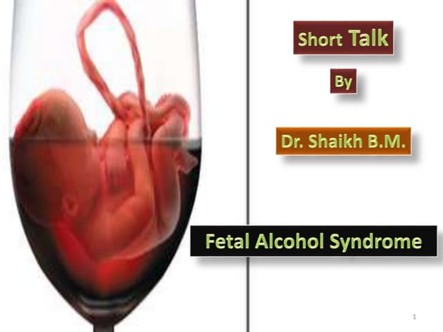 FETAL ALCOHOL SYNDROME(FAS) | PPTX
