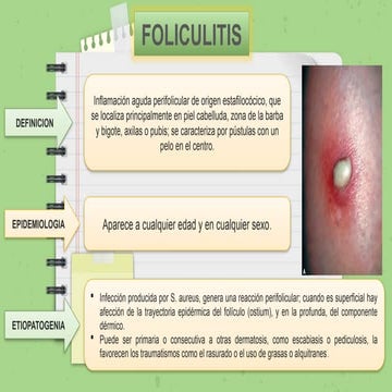 Dermatología, Infecciom bacteriana Foliculitis | PPTX