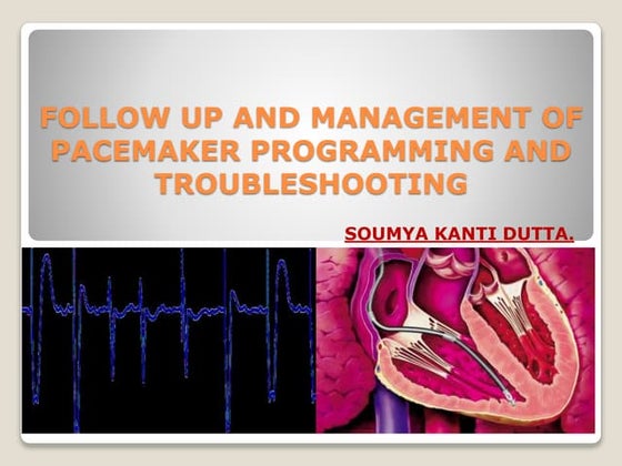 Cardiac Pacemaker | PPT