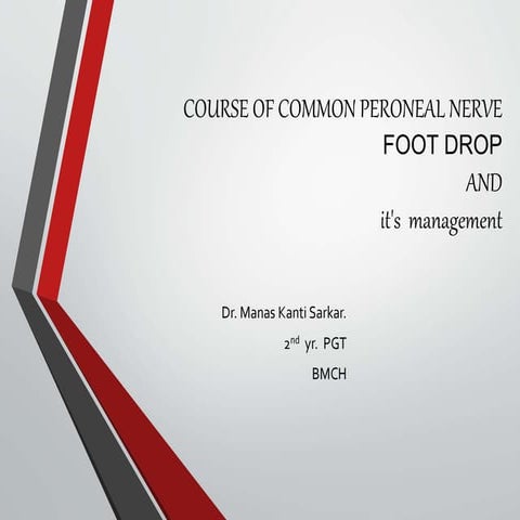 Foot drop | PPTX