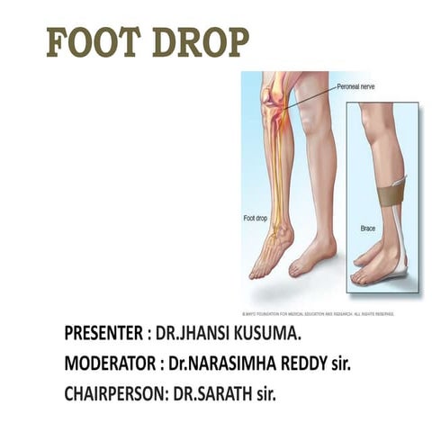 Foot drop | PPTX | Death, Injury, or Military Conflict | Sensitive Topics