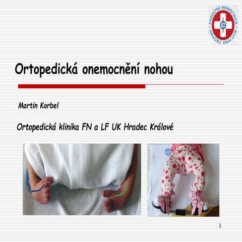 Ortopedická onemocnění nohou | PPTX