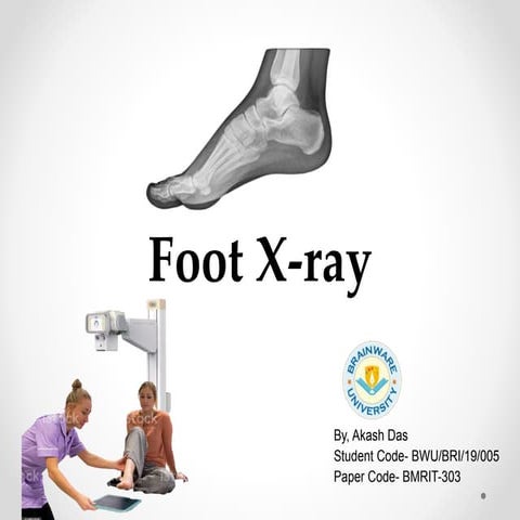 X-RAY views for foot, calcaneum, and ankle joint. | PDF