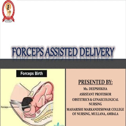 FORCEPS DELIVERY............ | PPTX