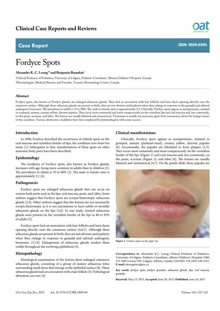 Bells Palsy iCliniq | PPT