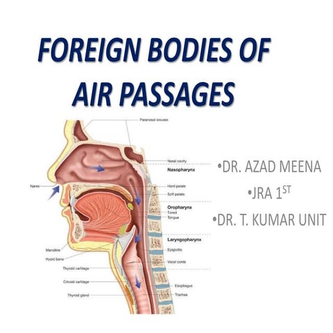 Foreign bodies of air passages | PPTX