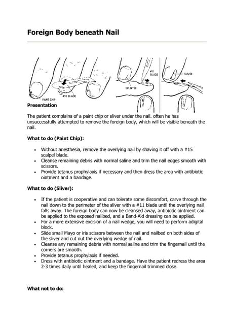 Conjunctival Foreign Body | PDF