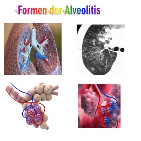 Formen der Alveolitis, Allgemeine Funktionsdiagnostik mit (BGA ...