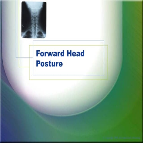 Forward Head Posture Powerpoint | PPT