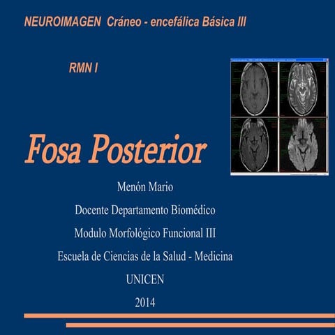 Fosa posterior rmn (1) | PDF