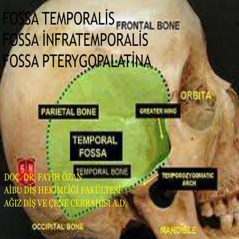 Fossa temporali̇s, i̇nfratemporali̇ ve pterygopalati̇na | PPTX