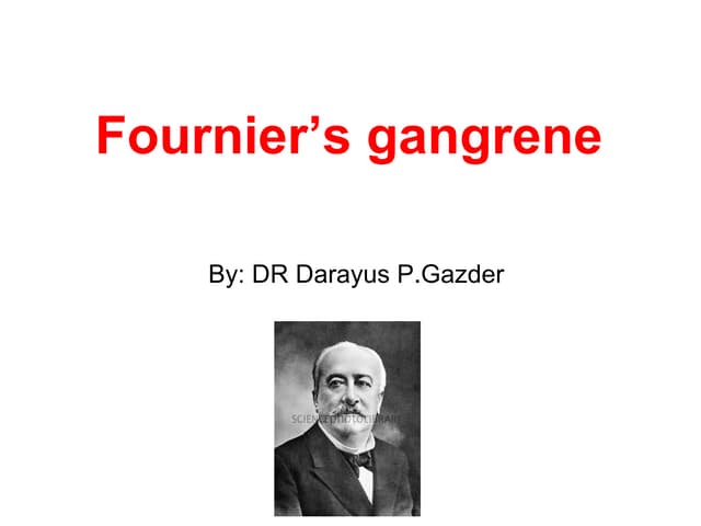 THE DIAGNOSIS AND MANAGEMENT OF FOURNIER'S GANGRENE.pptx