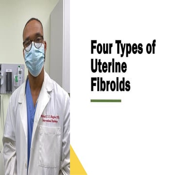 Four Types of Uterine Fibroids: An Overview | PPTX