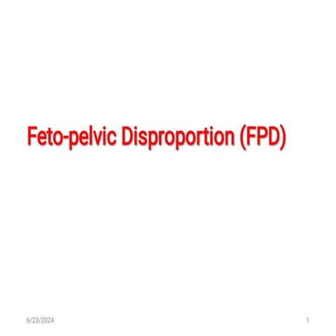 Feto pelvic disproportion.........hhhppt. | PDF