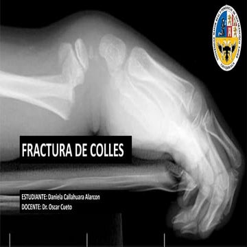 fractura de colles traumatologia, muñeca | PPTX