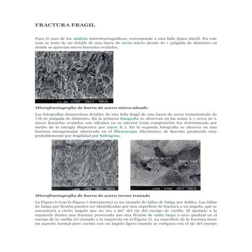 Fractura fragil | DOCX