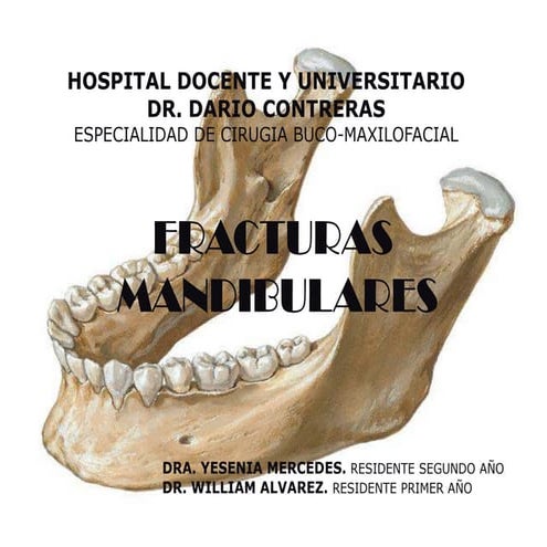 ABSCESO SUBMANDIBULAR DE ORIGEN ODONTOGENICO. | DOCX