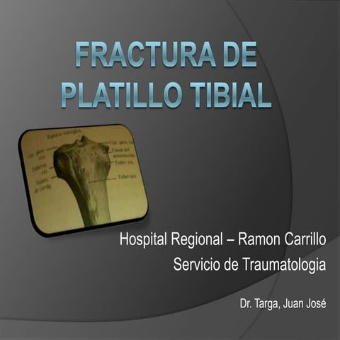 Fracturas de platillo tibial | PPTX