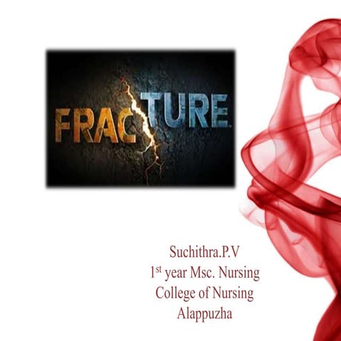Fracture | PPTX