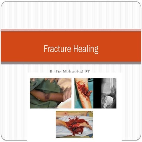 Fracture Healing in clinical orthopedics | PPTX