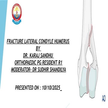 Lateral condyle fracture humerus | PPTX