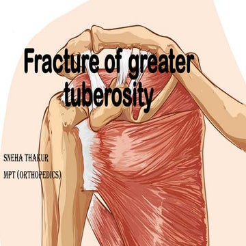 Fracture of greater tuberosity & physiotherapy management | PPTX