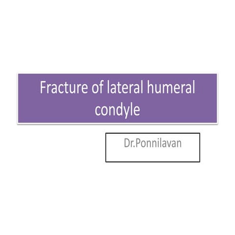 Fracture of lateral humeral condyle | PPTX