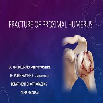 FRACTURE OF PROXIMAL HUMERUS- Etiopathogenesis , clinical features and ...