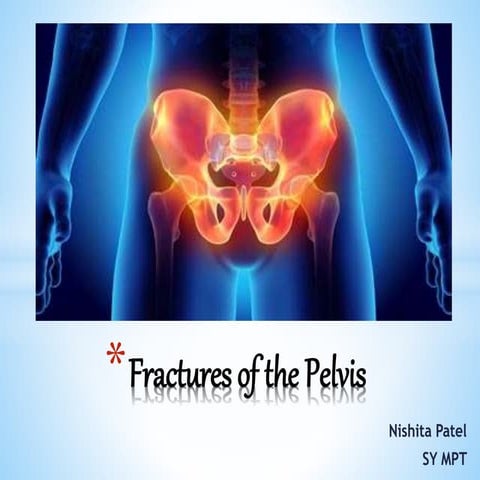 Fractures of the Pelvis bone and its physiotherapy rehabilitation .pptx