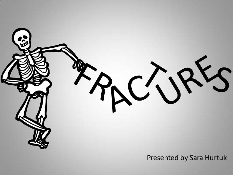 FRACTURE CHAPTER 4 PRESENTATION