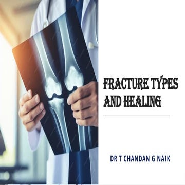 Basic anatomy of Bone , Fracture and Healing | PPTX