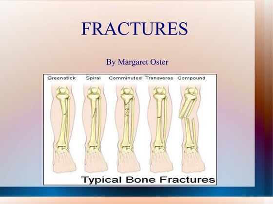 FRACTURE (TYPES AND PATTERN) | PPT