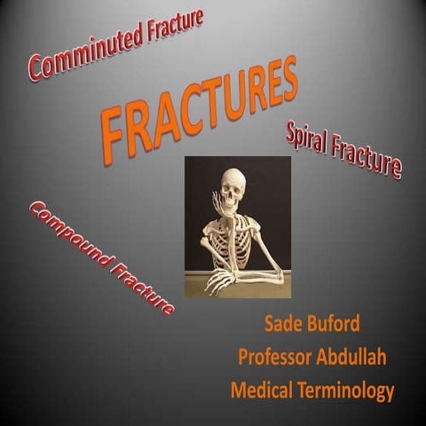 Fractures | PPT