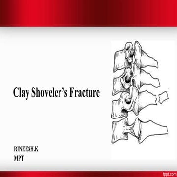 Cervical Fractures(clay shovelers,hangmans,odontoid) | PPTX