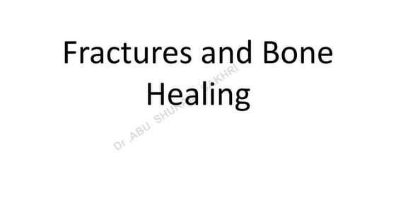 3 bone fractures | PPT