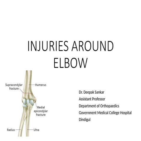 Fractures around elbow joint and its complications | PPTX