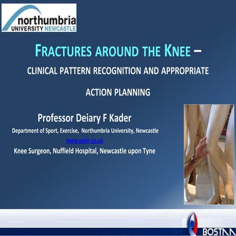 Fractures around the knee for connect Physio Newcastle | PPTX