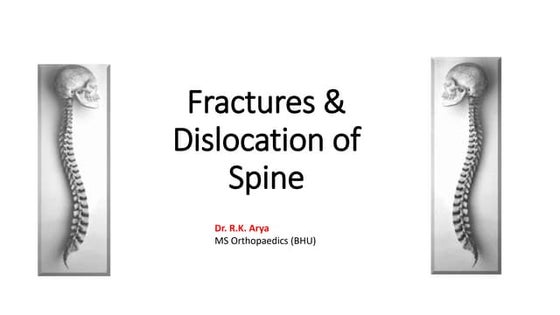 Fracture of the Spine as one of the major orthopedic trauma .pdf