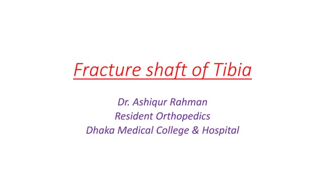 Radial head fracture | PPTX