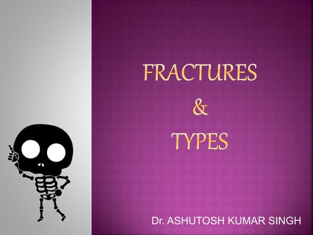 FRACTURE (TYPES AND PATTERN) | PPTX